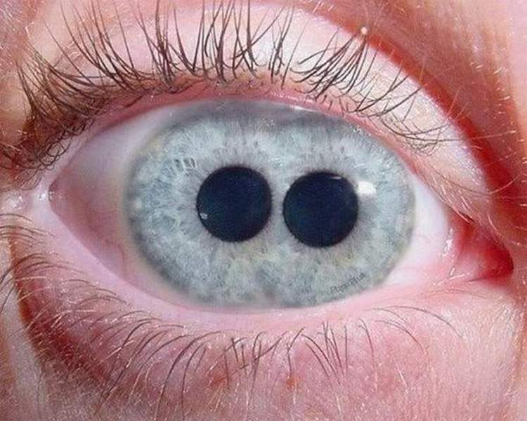 eyes - RVCJ Media