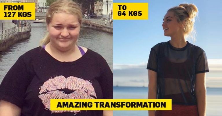 This Teenage Girl Was 127 Kilos And Lost 63 Kilos Weight In 1 Year ...